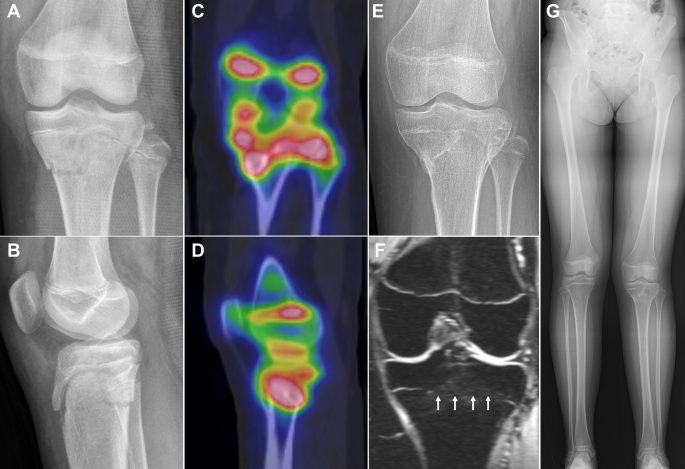 How Pediatric Imaging Helps in Early Detection of Bone Growth ...